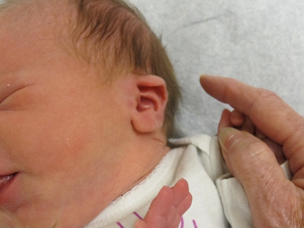 Case #9898 - Wilson Plastic Surgery