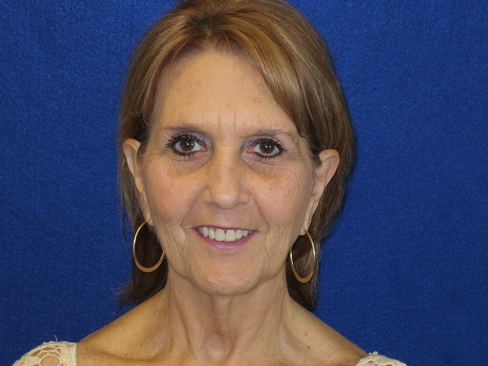 Case #2576 - Wilson Plastic Surgery