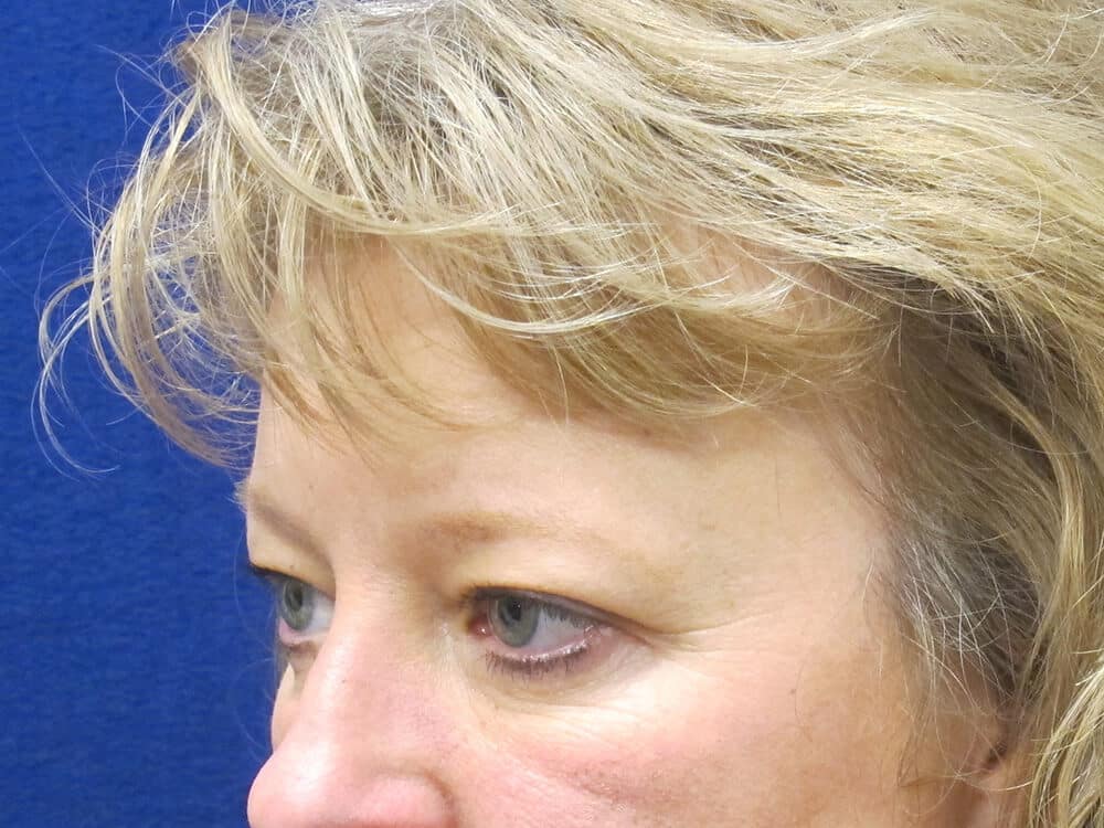 Case #2641 - Wilson Plastic Surgery