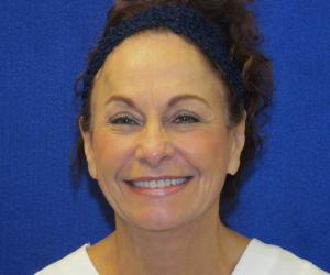 Case #2831 - Wilson Plastic Surgery