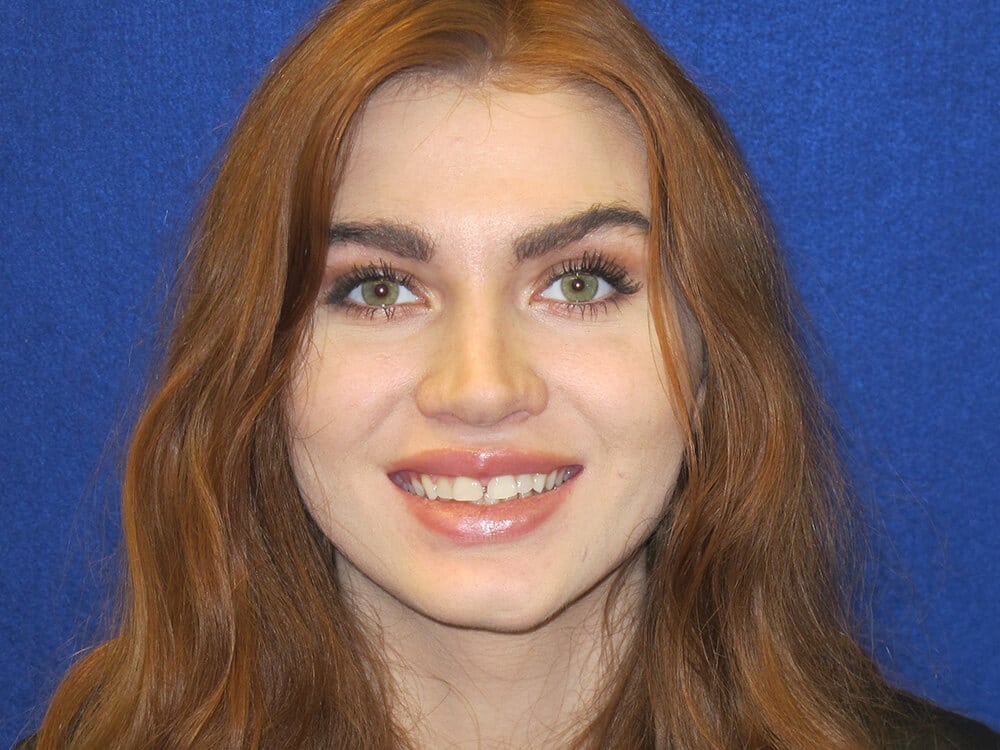 Case #7286 - Wilson Plastic Surgery